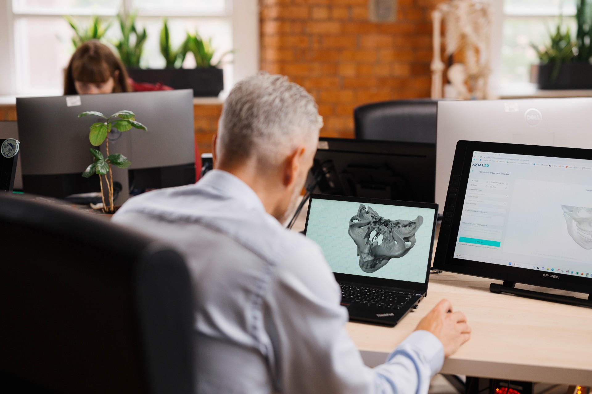 How to create actionable 3D data from medical images - Axial3D