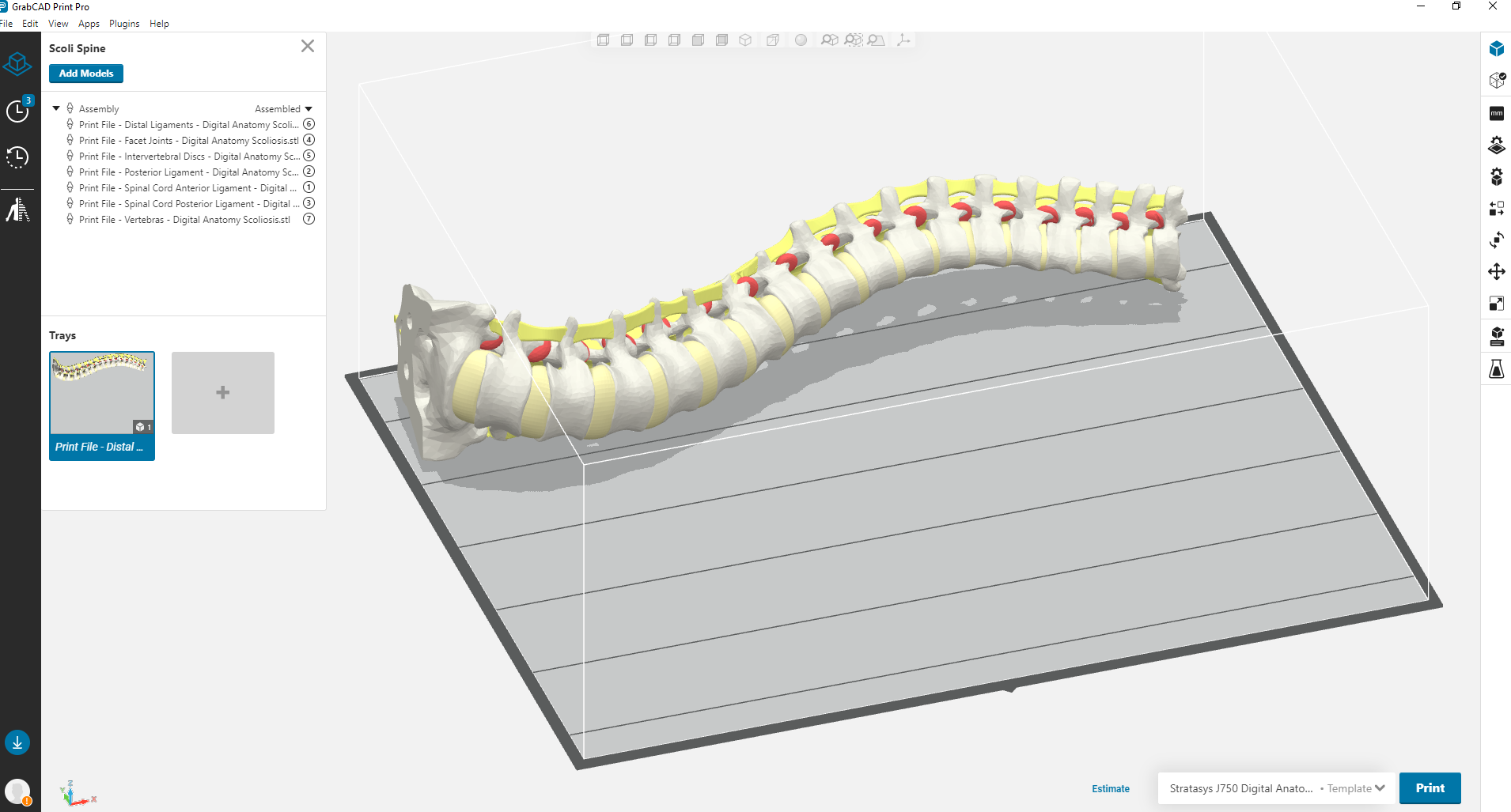 3D Print Ready File - Axial3D