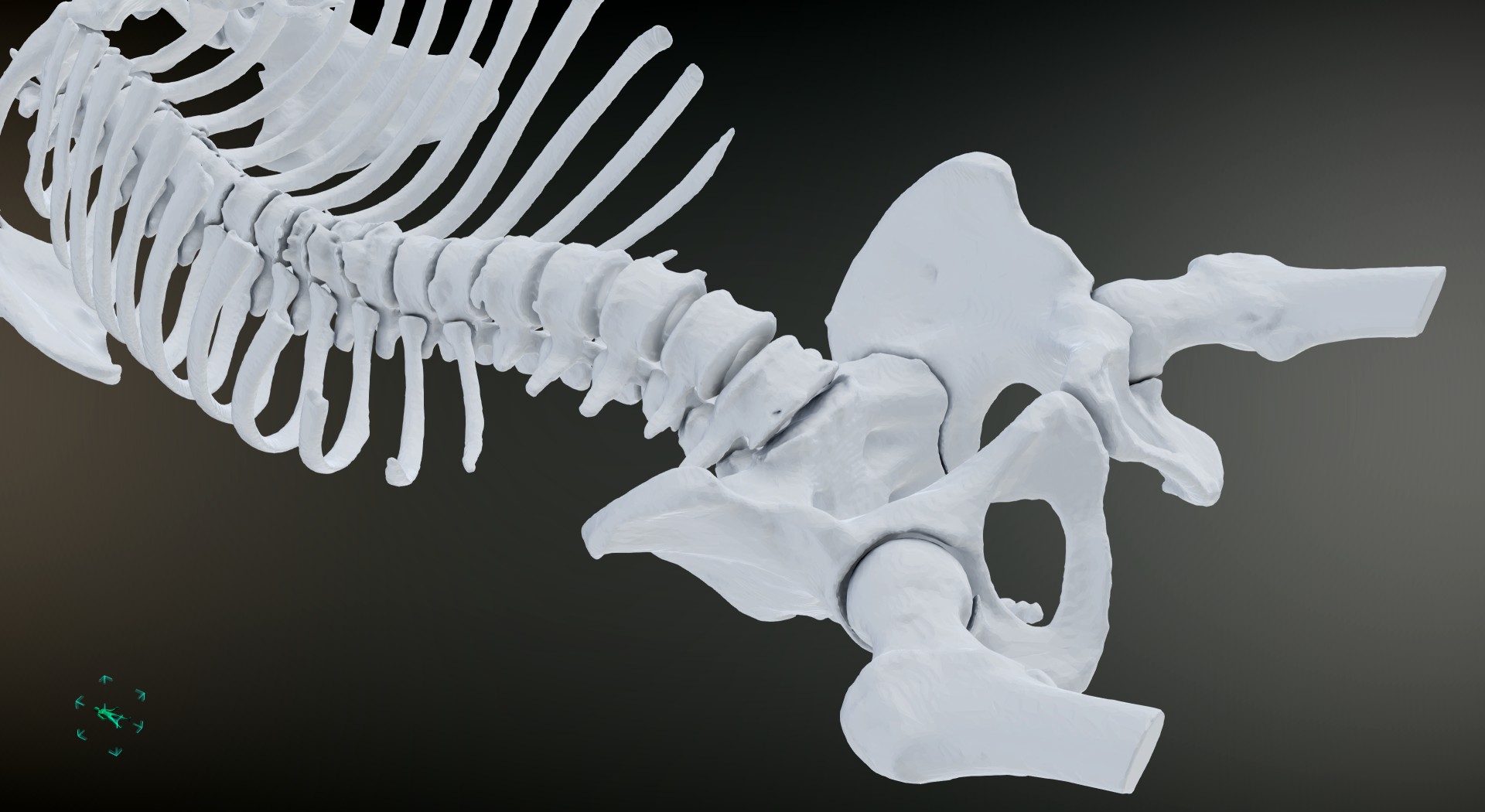 Orthopaedic and Spine - Axial3D