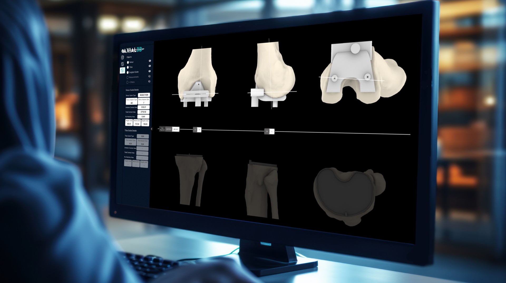 Axial3D - Leading the way with the latest 3D imaging, models, and devices