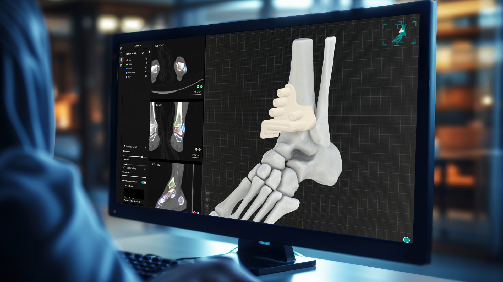 Axial3D AXCEL - Axial3D