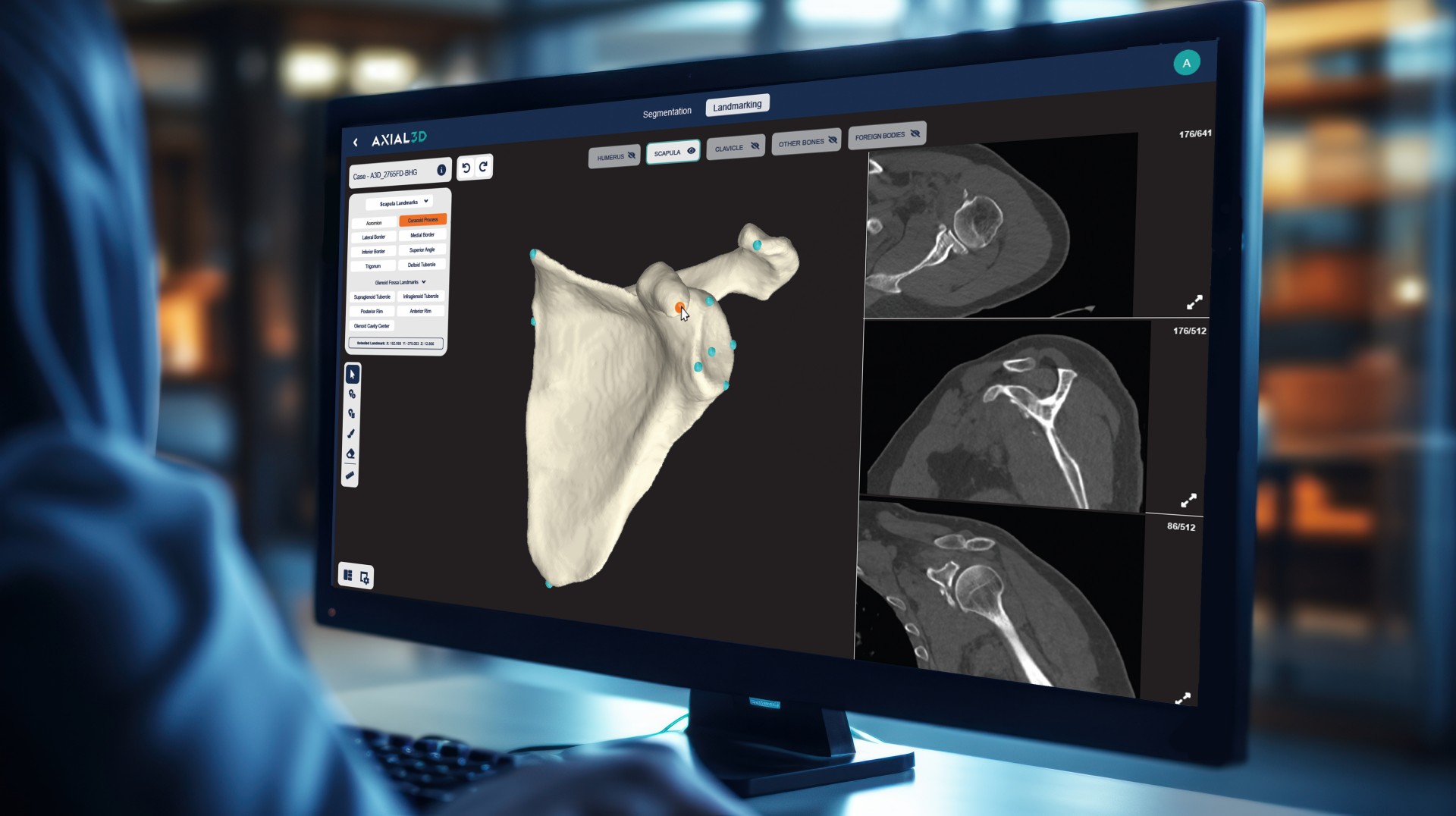 Axial3D - Leading the way with the latest 3D imaging, models, and devices