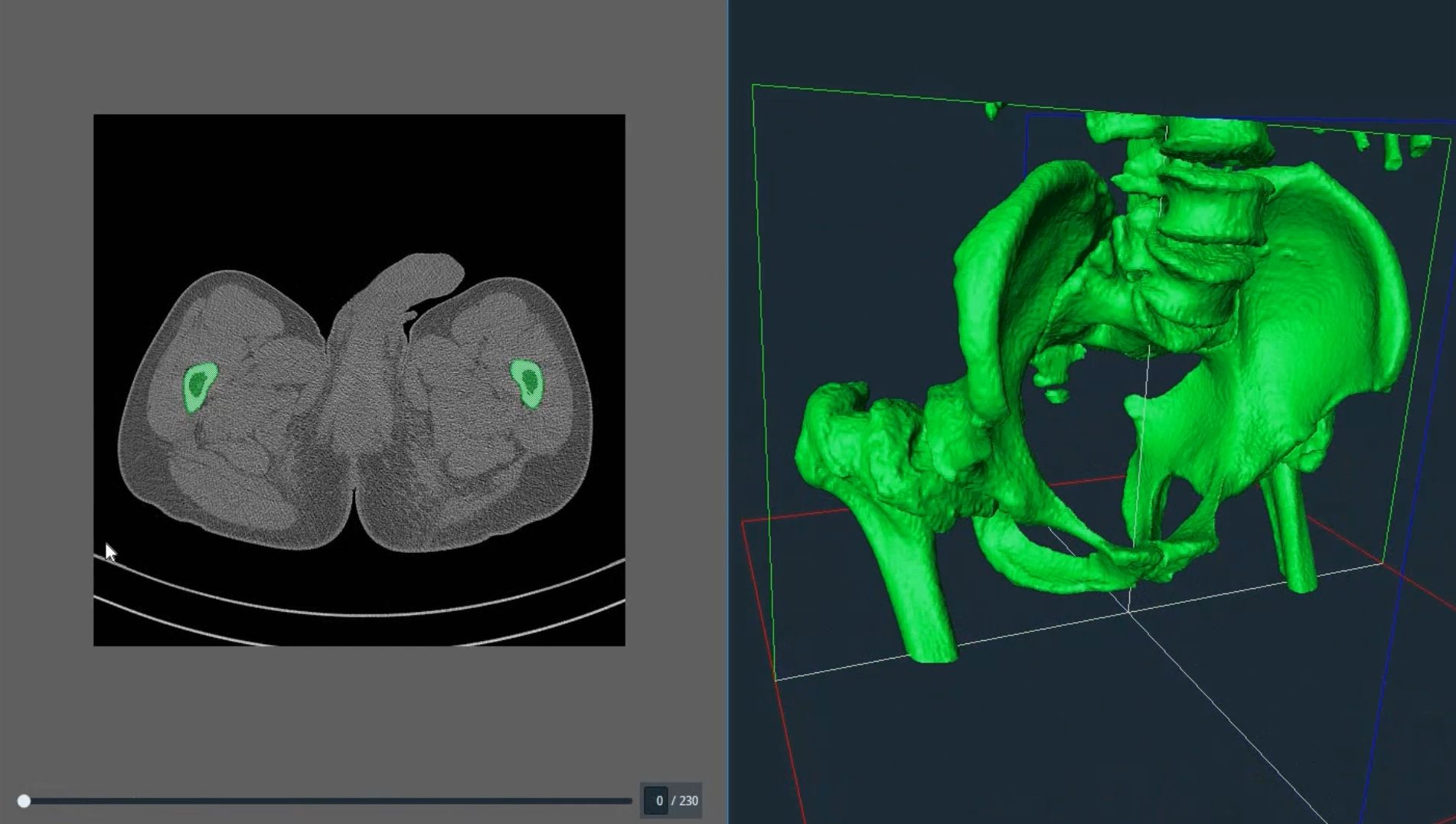 Why the Convergence of AI, Machine Learning, and 3D Imaging are the ...