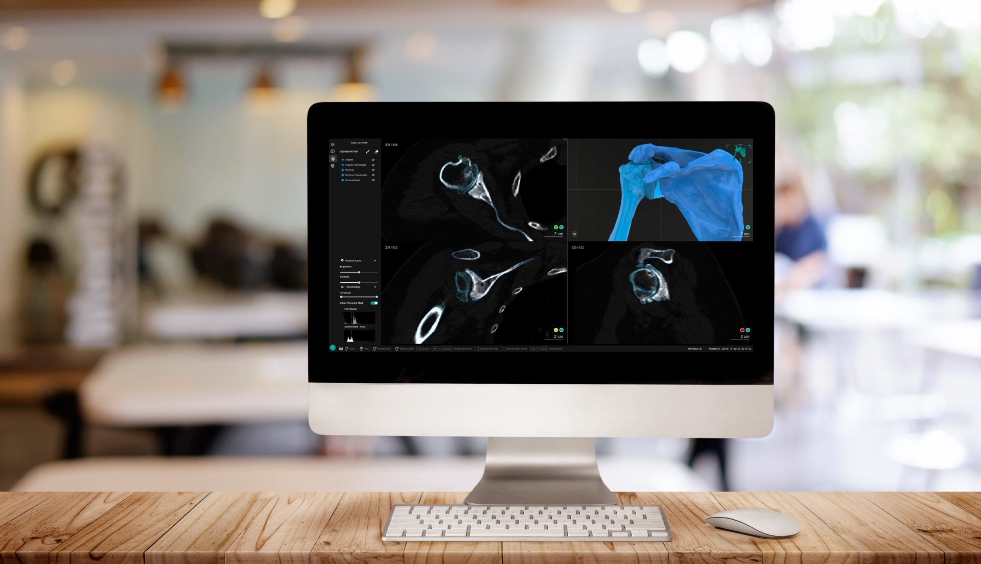 Axial3D - Leading the way with the latest 3D imaging, models, and devices