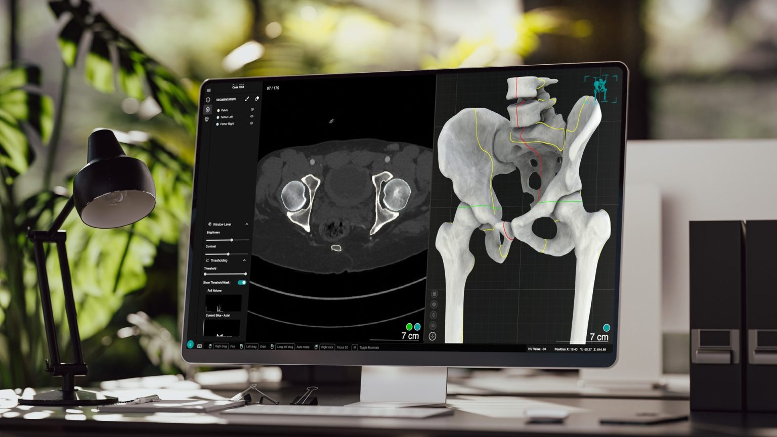 Axial3D - Leading the way with the latest 3D imaging, models, and devices