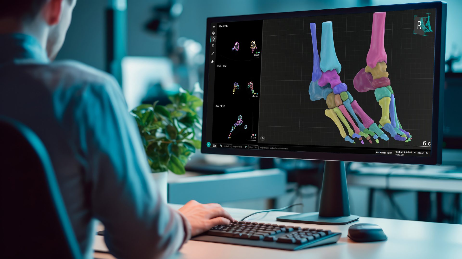 Axial3D - Leading the way with the latest 3D imaging, models, and devices